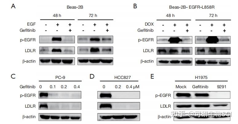 文献精读：EGFR突变非小细胞肺癌的一种有前途的代谢疗法 - 知乎
