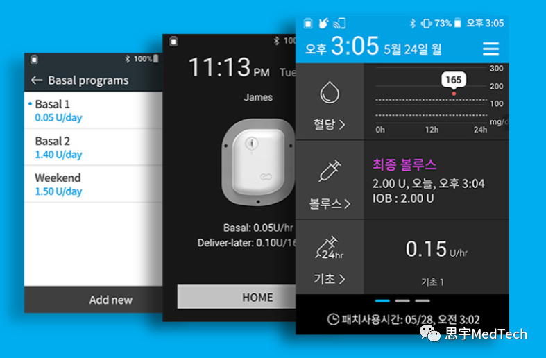 一次性胰岛素泵，扩展美国市场 - 知乎