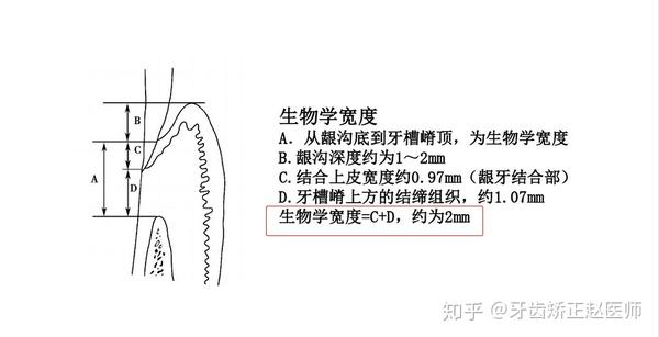 牙龈萎缩了,还可以长回来吗? 知乎