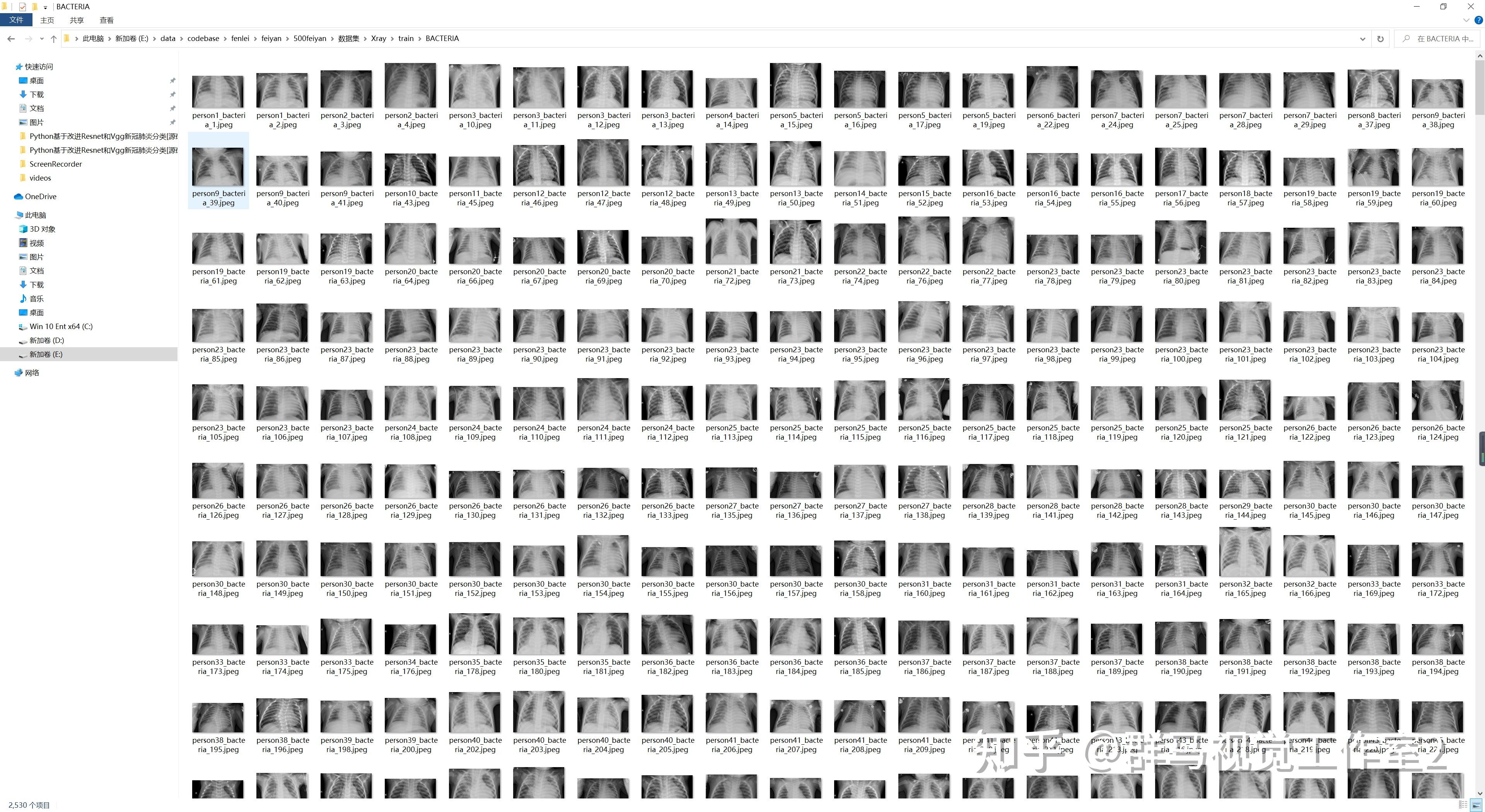 Python基于改进Vgg＆Resnet新冠肺炎分类[源码＆部署教程] - 知乎