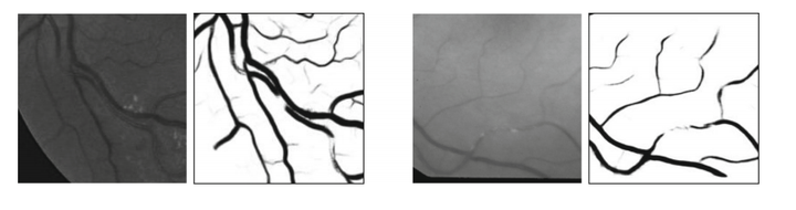 Topology Coherence in Blood Vessel Segmentation - 知乎