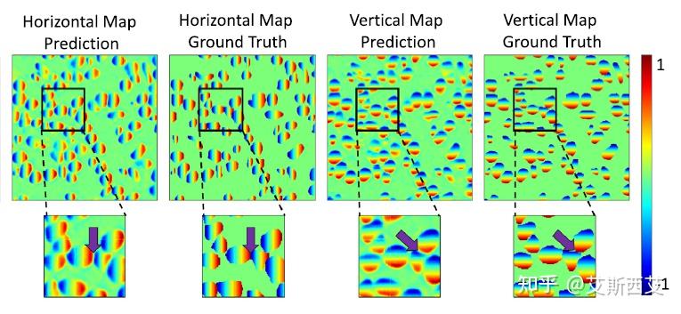 Hover-Net: Simultaneous segmentation and classification of nuclei in multi-tissue histology ...