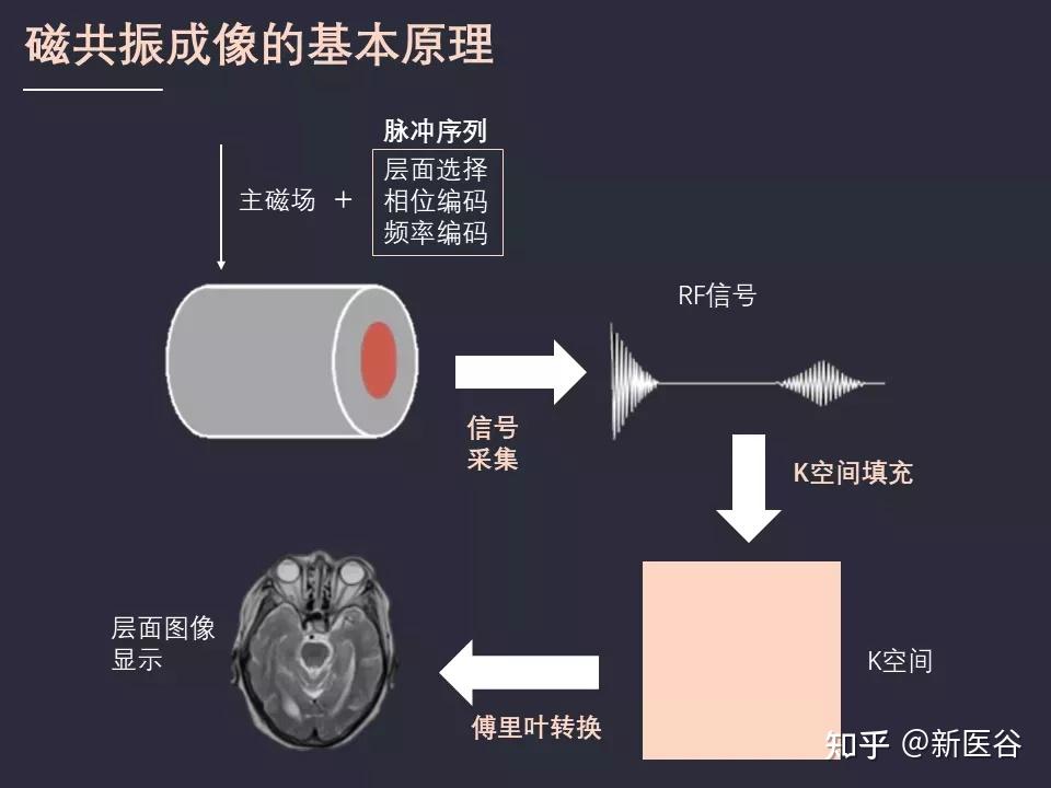 影像时间|MRI的“存储器”——K Space - 知乎
