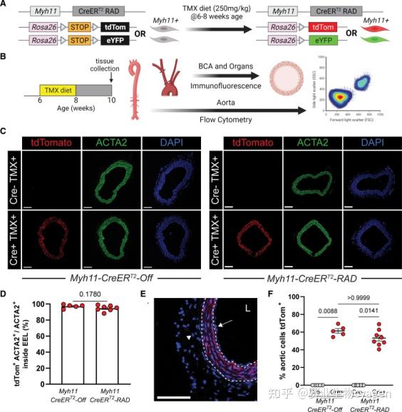 弗吉尼亚大学发现全新Myh11-CreERT2-RAD小鼠可作为平滑肌细胞研究的新工具 - 知乎
