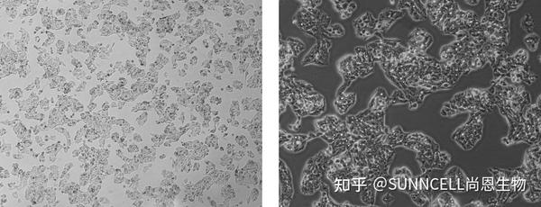 细胞攻略 | HepG2(人肝癌细胞)培养教程 - 知乎