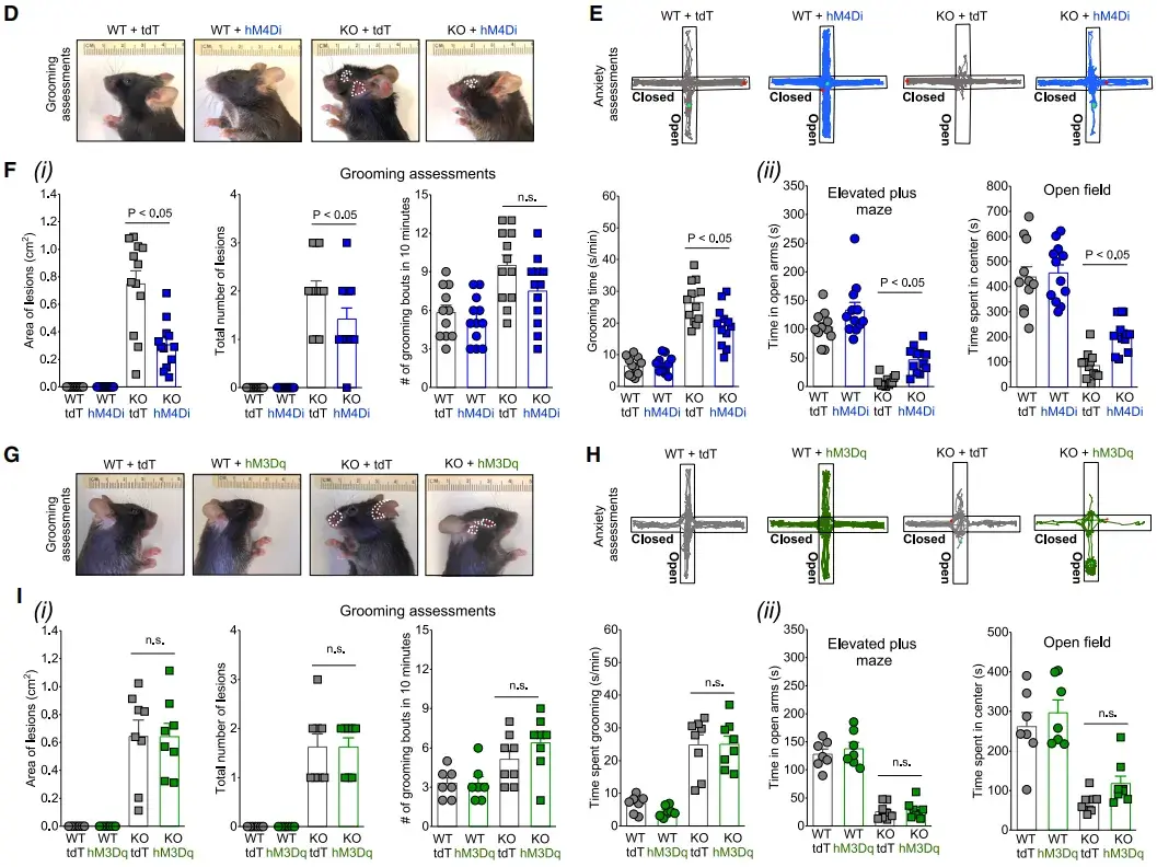 Neuron | LifeAct-GFP肌动蛋白细胞骨架标记物揭示星形胶质细胞Gi-GPCR信号通路在强迫和焦虑行为中的作用 - 知乎