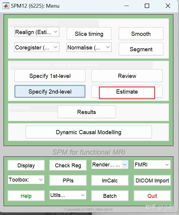 13-SPM-fmri任务态 二阶分析：多因素方差分析 - 知乎