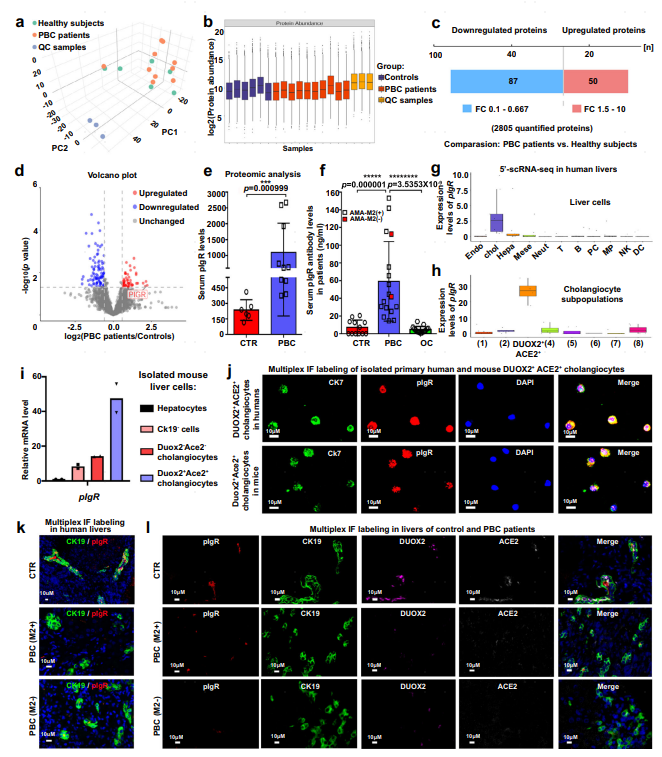项目文章 | DUOX2+ACE2+小胆管细胞是原发性胆汁性胆管炎的致病靶点 - 知乎