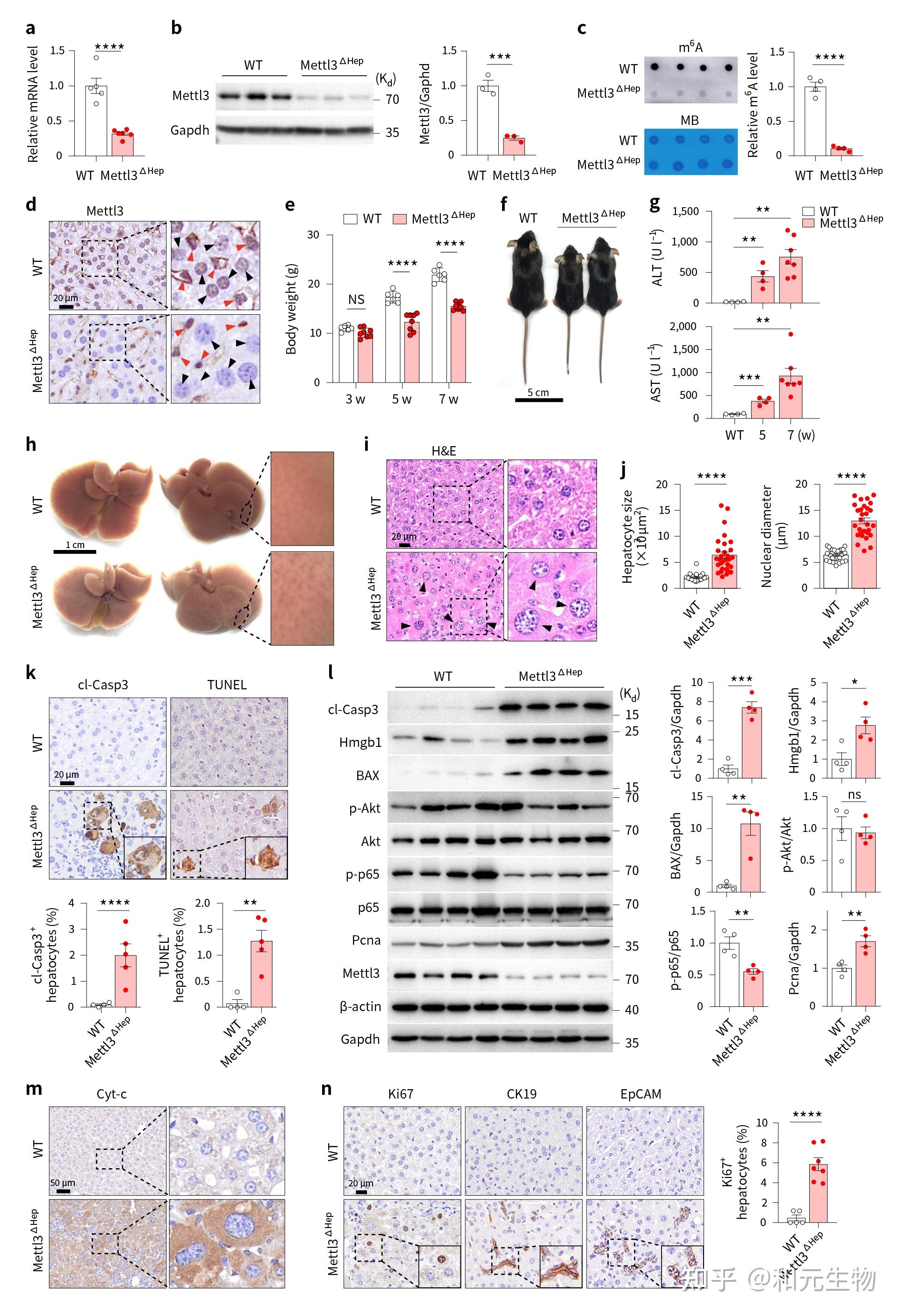 Nat Metab | 山大袁得天/李石洋/武大夏宇尘合作揭示肝脏发育和功能成熟的调控机制 - 知乎