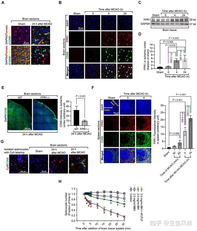 Theranostics：FPR1促进脾细胞迁移到大脑和促炎细胞因子的产生 - 知乎