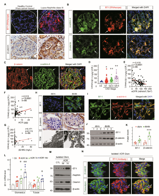 Cell Death Differ｜周丽丽团队发现足细胞损伤的重要机制 - 知乎