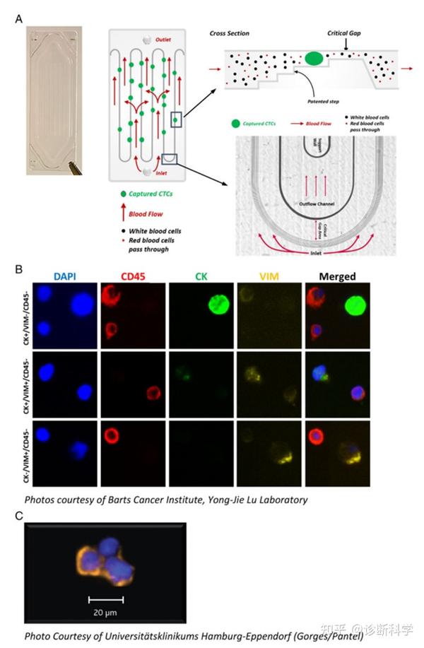 市场 | CTC检测临床应用突破！乳腺癌细胞分离系统获得FDA批准 - 知乎