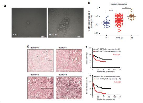 解锁外泌体之外泌体RNA研究思路 - 知乎