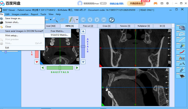 使用NNT Viewer把CBCT进行格式转化（.a111->.dcm） - 知乎