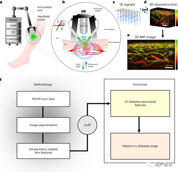Nature Biomedical Engineering | 光声检测皮肤血管病与糖尿病阶段的相关关系 - 知乎