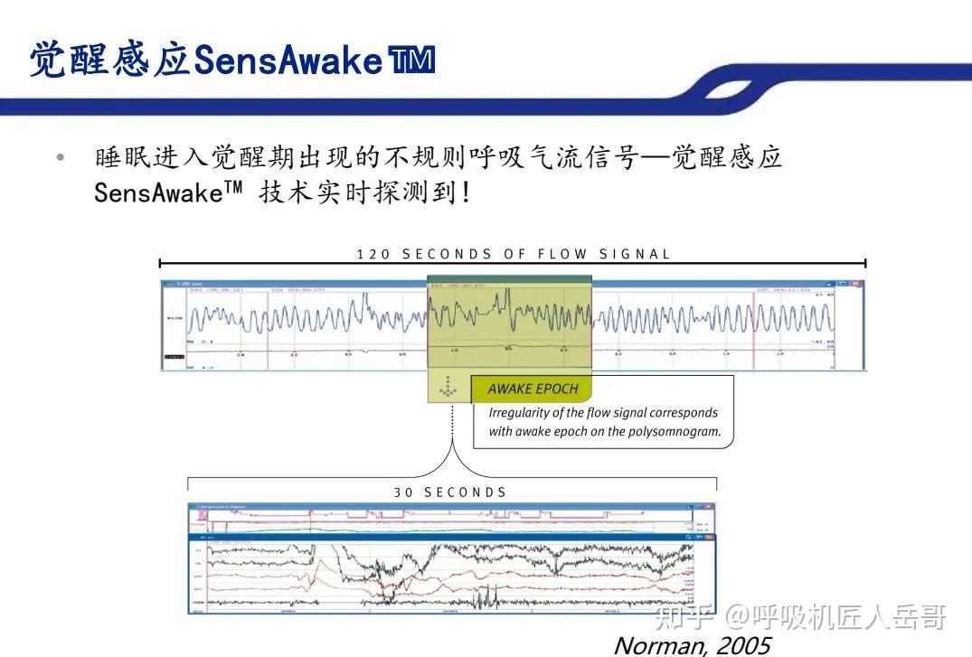 匠人独家：全面评测费雪派克SleepStyle单水平全自动呼吸机 - 知乎