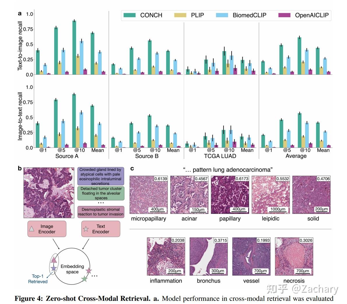 Nature Medicine最新研究：哈佛医学院开发迄今为止最大的两个病理AI基础模型（一）CONCH - 知乎
