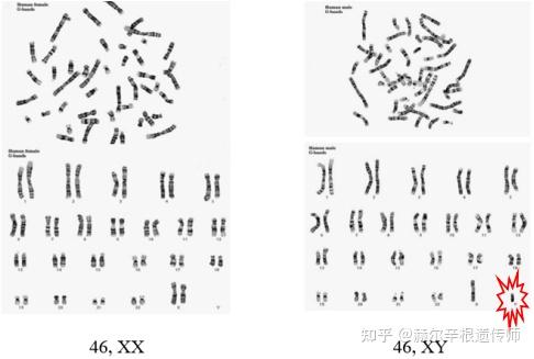 性别决定基因-SRY - 知乎