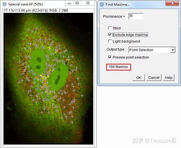ImageJ实用技巧——细胞计数综述 - 知乎
