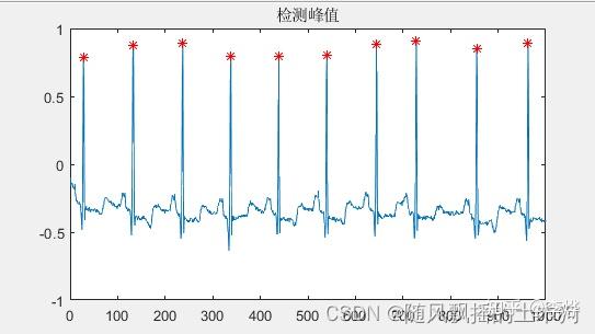 【matlab第30期】基于matlab的lstm深度学习模型的自动检测时间序列数据峰值算法 知乎 