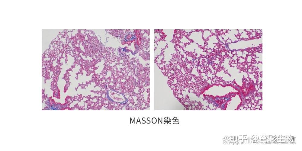 ZCIBIO---Masson染色;一个看组织纤维化的染色实验 - 知乎