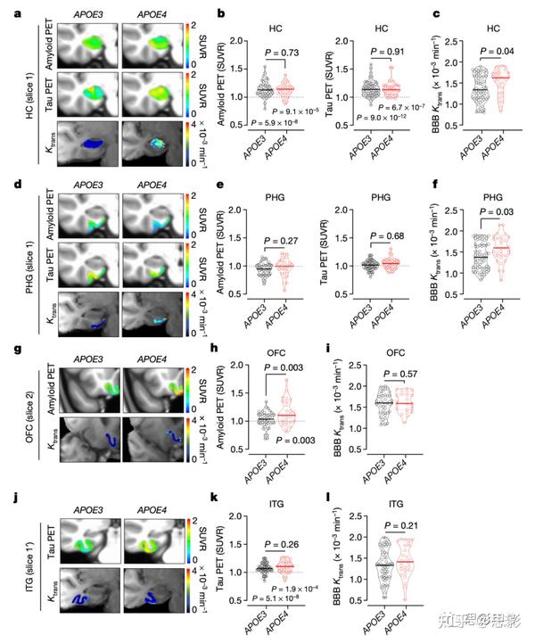 Nature：APOE4诱发血脑屏障功能障碍可预测认知功能下降 - 知乎