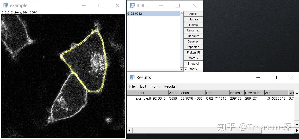 ImageJ实用教程——细胞膜荧光强度检测(定量分析篇) | 斯博利康-细胞生物学液体试剂专家