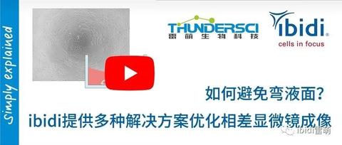 ibidi成像科普课堂 |相差显微镜的原理相差显微镜是如何工作的？ - 知乎