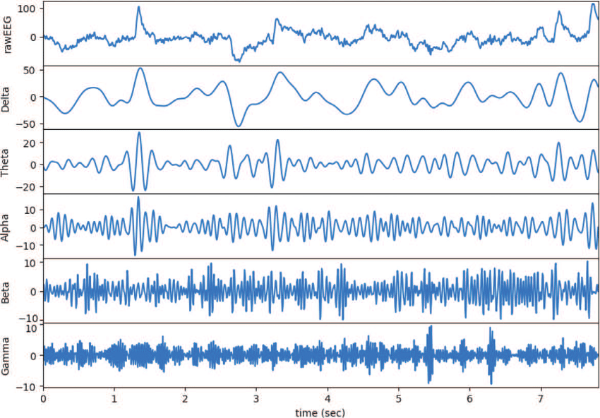 [51] EEG Conformer: 融合 CNN 和 Transformer处理 EEG 数据 - 知乎