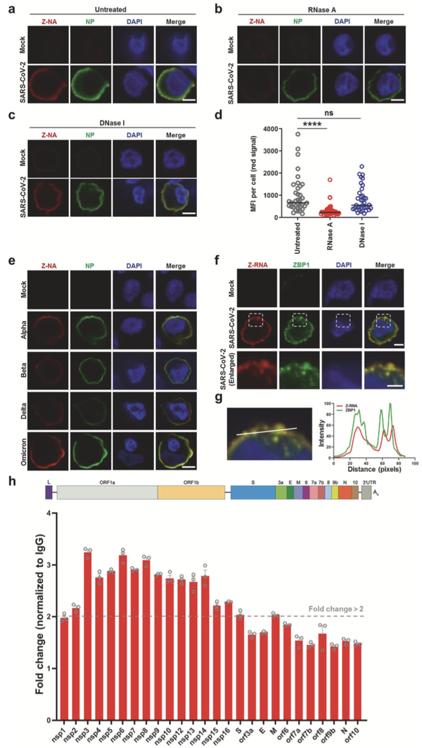 国产顶刊Cell Research丨SARS-CoV-2 Z-RNA 激活 ZBP1-RIPK3 通路以促进病毒诱导的炎症反应 - 知乎