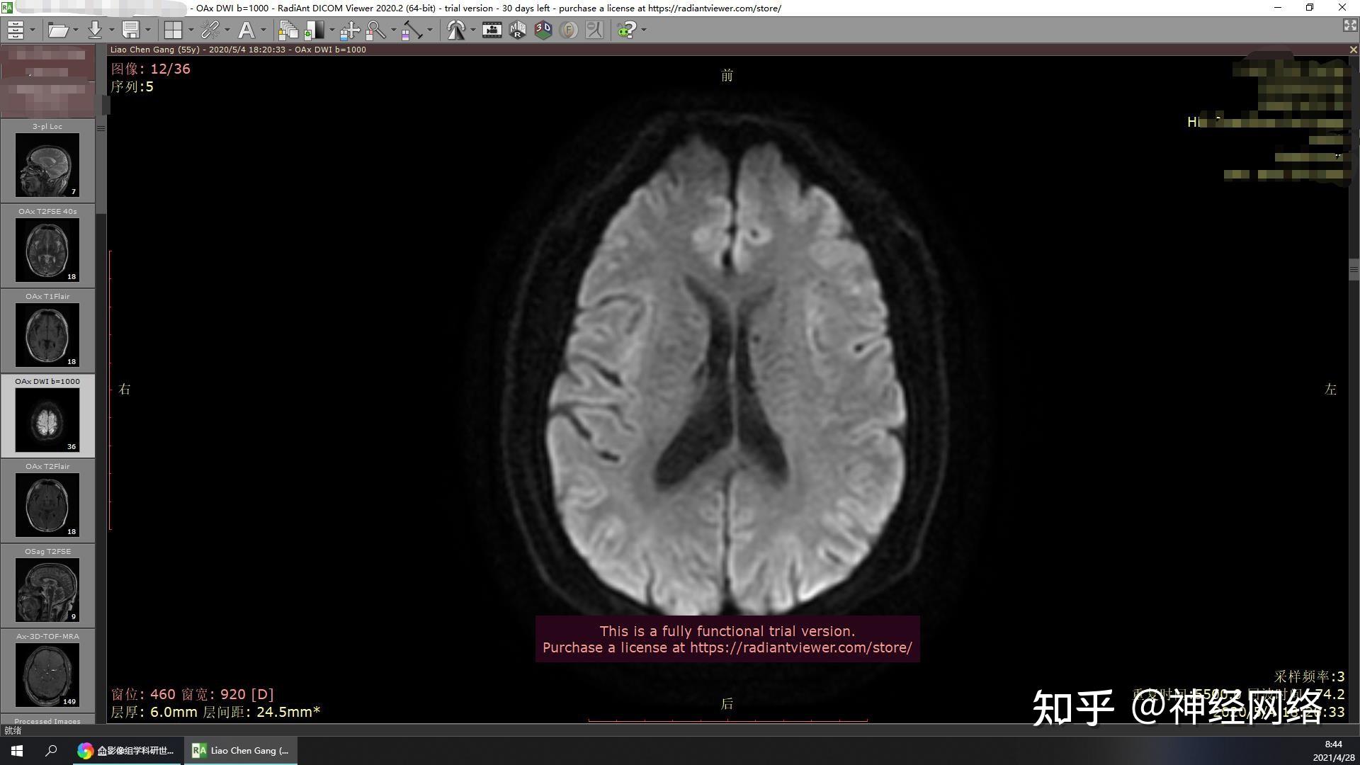 分享八个各有优势的 DICOM 图像阅读和科研处理软件 - 知乎