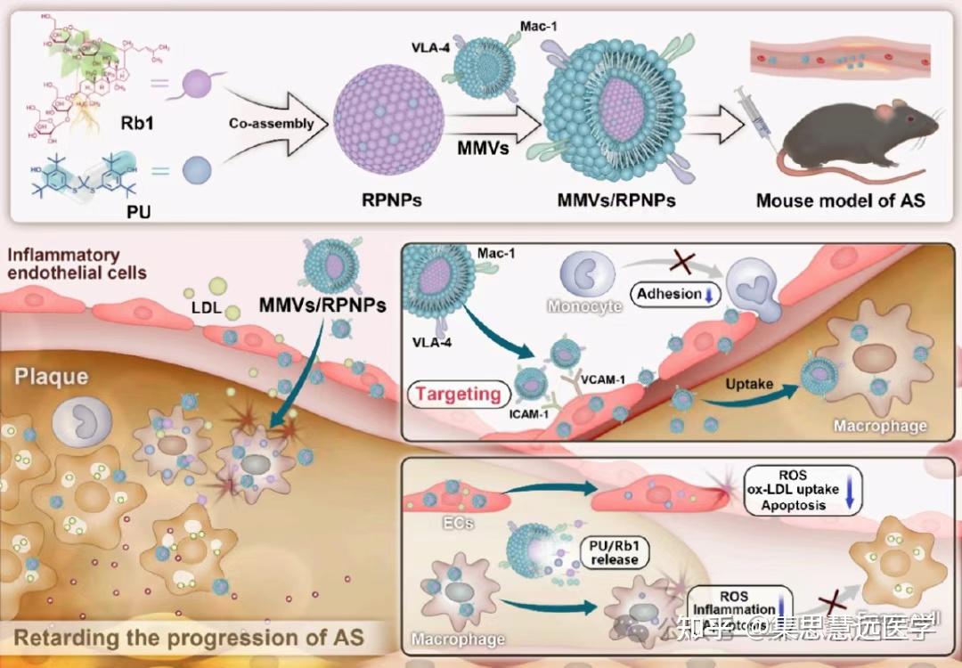 ACS nano|中药自组装赋能人参皂苷 Rb1-普罗布考共组装纳米粒，靶向 AS 病灶同步抗氧化、抗炎、抑脂质沉积 - 知乎