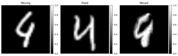 分割图——SynthMorph，零样本学习完成跨模态配准任务 - 知乎