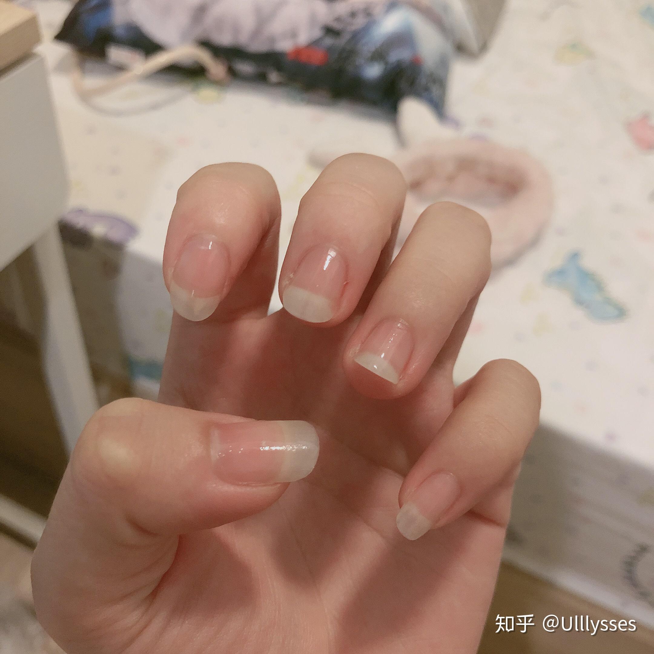 指甲小是怎样的体验？ 知乎