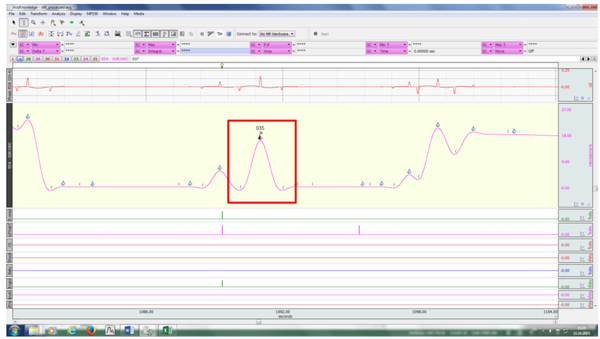 AcqKnowledge软件进行皮肤电反应（EDA/SCR）分析的详细教程 - 知乎