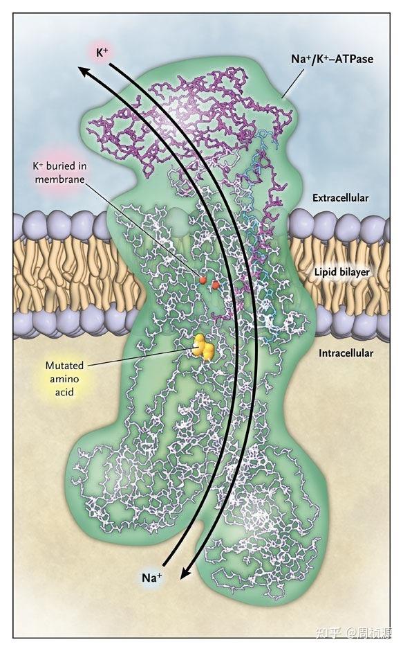 Nejm 2010 Case 17 - 知乎