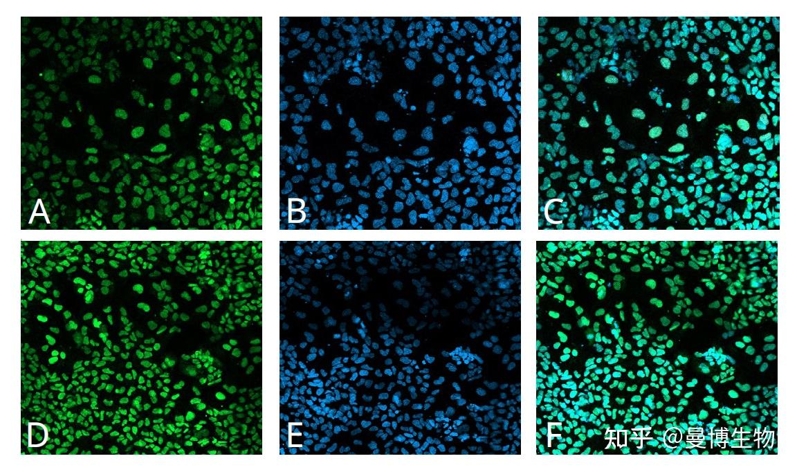 Qkine细胞因子：iPSC向三胚层分化系列--内胚层_曼博生物代理 - 知乎