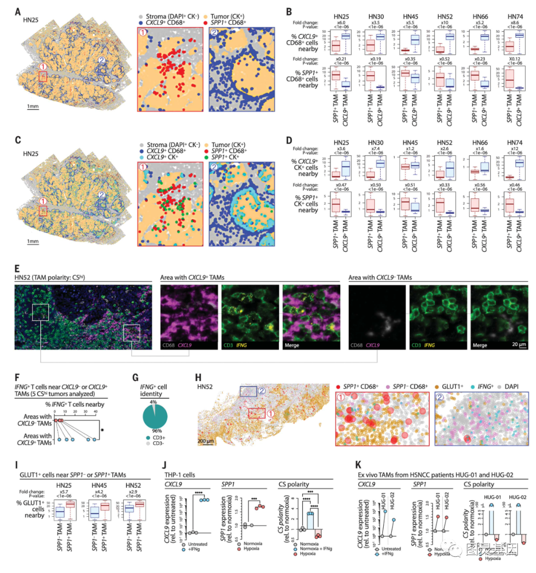 Science｜CXCL9:SPP1巨噬细胞极性确定是肿瘤微环境的一个简单而关键的特征 - 知乎