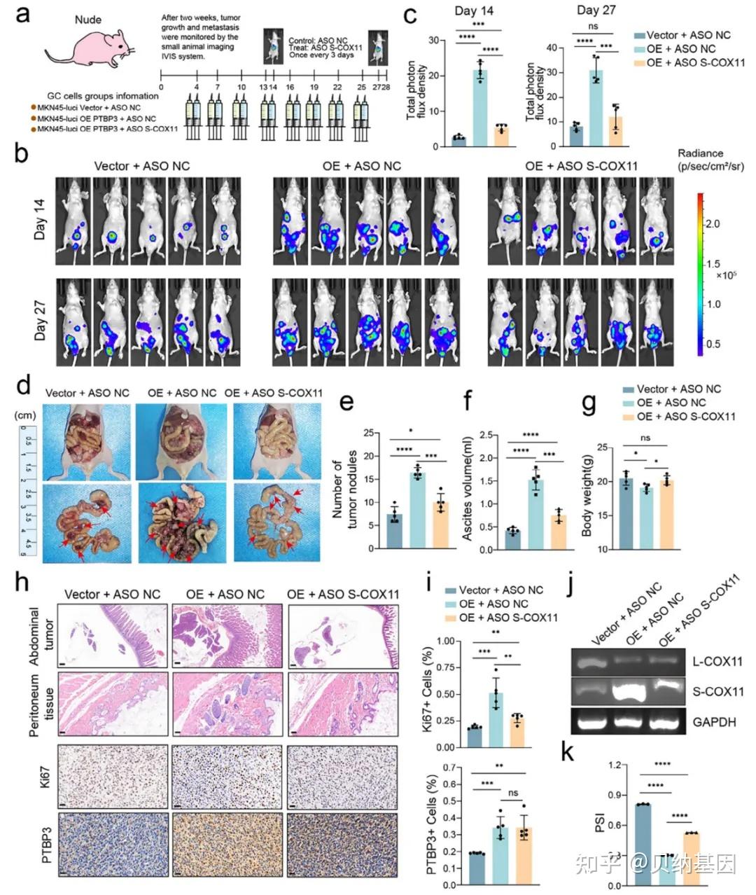 项目文章 | 苏大一附院破解胃癌腹膜转移难题！靶向PTBP3/COX11剪接轴，铜死亡疗法显神威！ - 知乎
