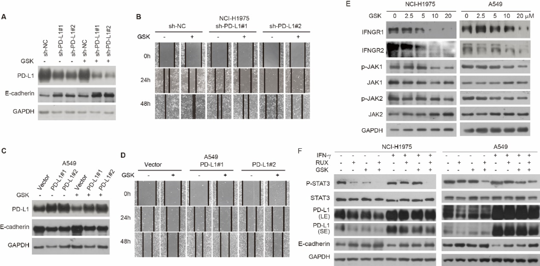 Genes Dis︱刘宏民/何鹏兴/徐义超团队发现阻断LSD1抑制肺腺癌增殖转移的新机制 - 知乎