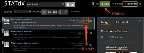 手把手教程：美国医生广泛好评的影像学工具STATdx用户指南 - 知乎