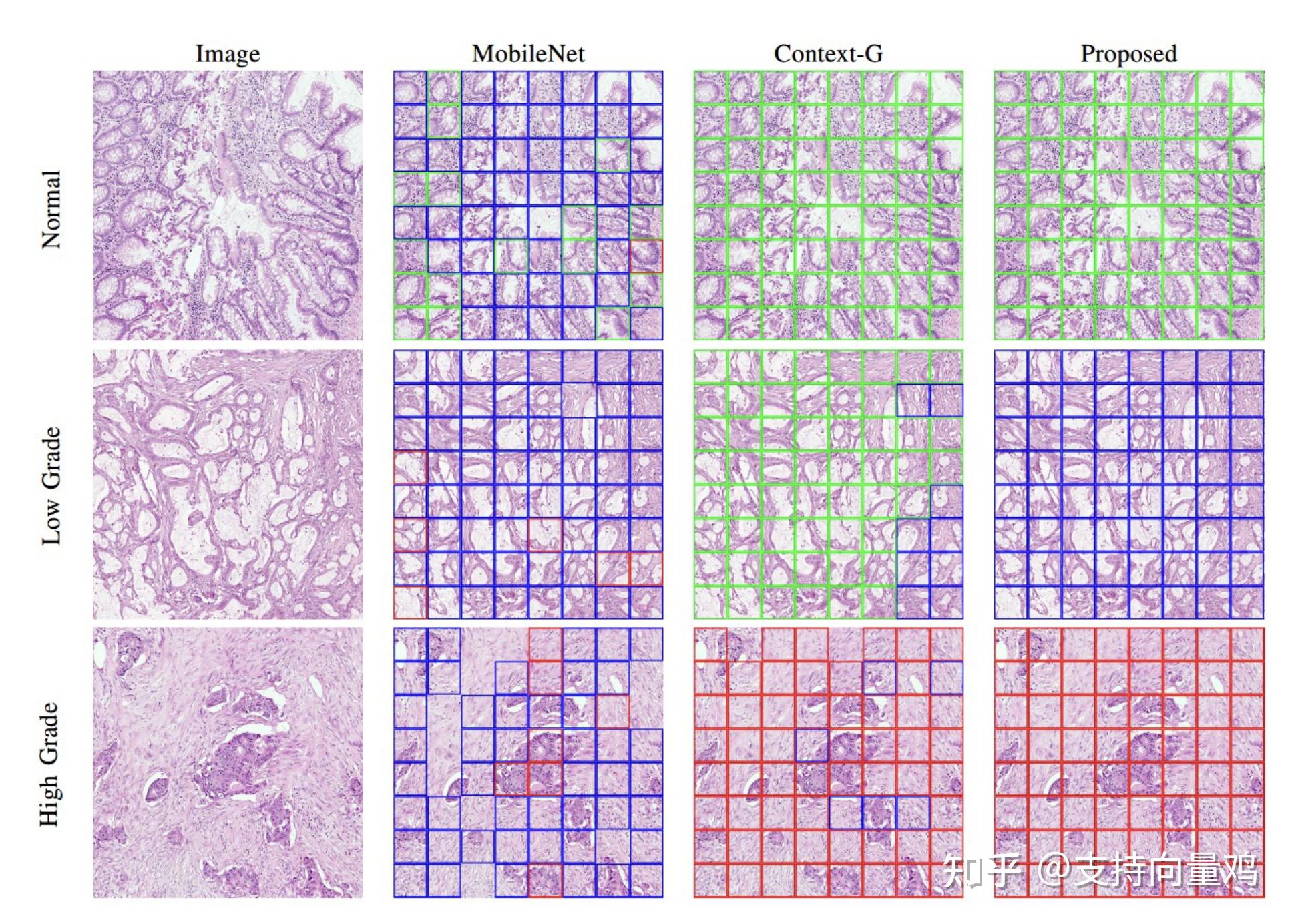 【论文精读】Context-Aware Convolutional Neural Network for Grading of ...