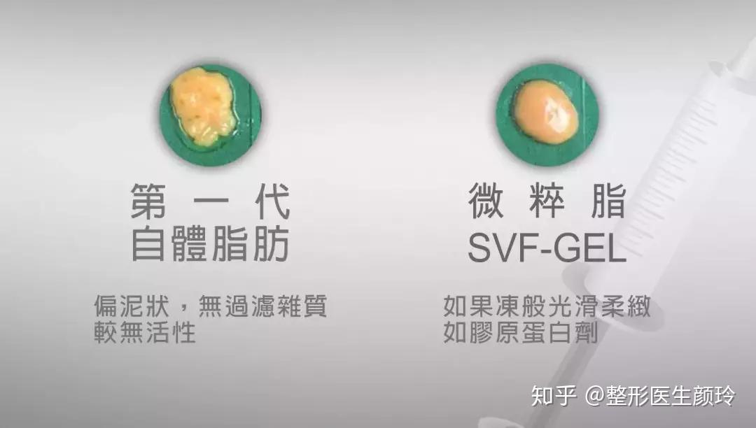 自体脂肪填充和SVF-GEL脂肪胶有什么区别？ - 知乎