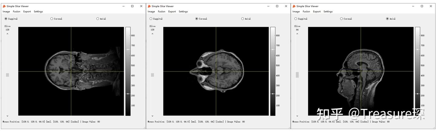Python科研图像处理——Slice Viewer - 知乎