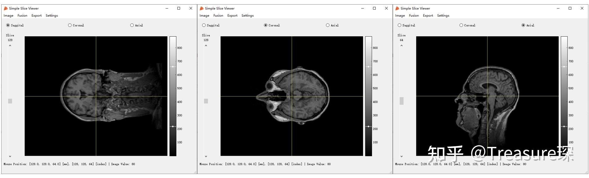 Python科研图像处理——Slice Viewer - 知乎