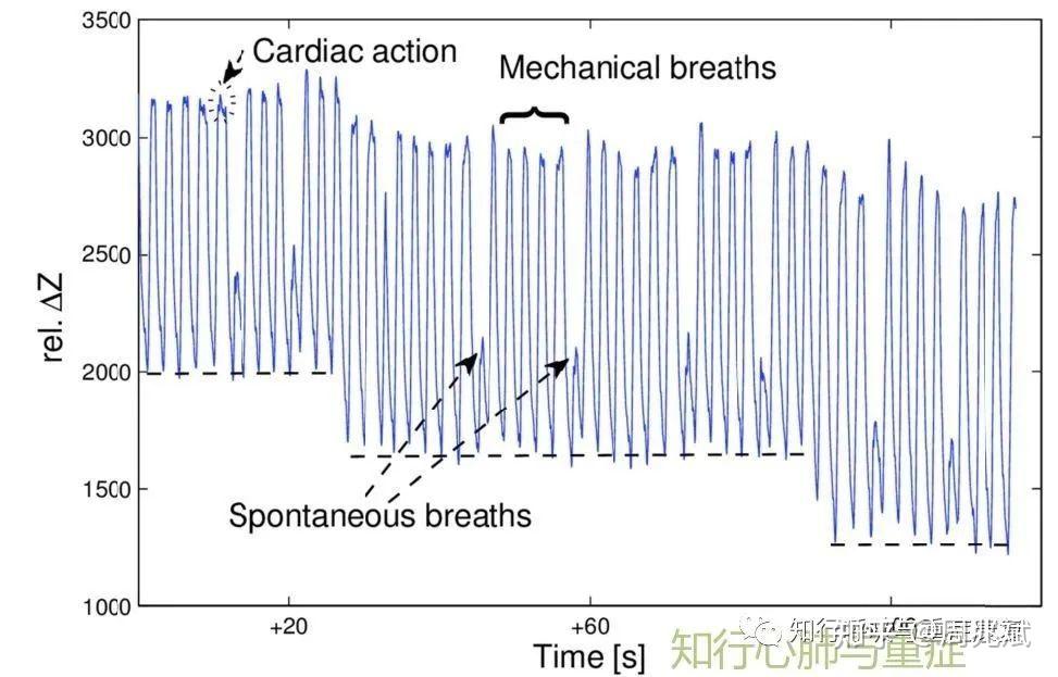 第139期胸部电阻抗断层成像（EIT）的原理、图像分析及临床应用 - 知乎