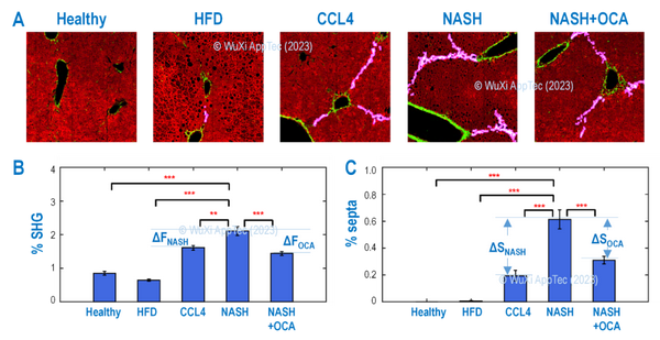 体内药理药效 | Resmetirom三期临床试验、THR-β及NASH新药临床前动物药效测试 - 知乎