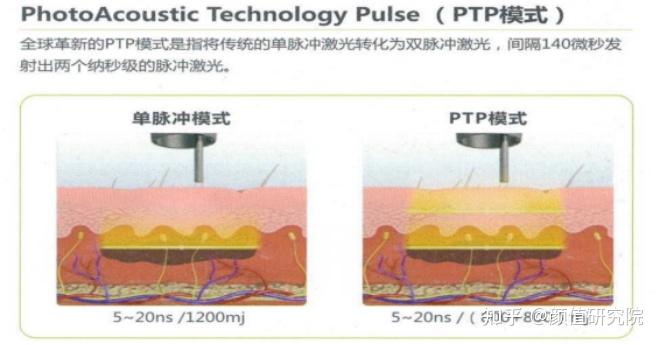 激光祛斑会不会留疤？做一次多少钱？去三甲医院还是医美机构好？有没有做过的能给点意见？
