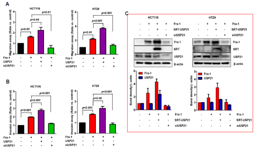 泛素特异性蛋白酶21通过充当Fra-1去泛素酶促进结直肠癌转移 - 知乎