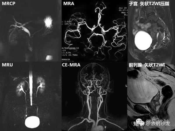 如何简单理解、认识MRI图像 - 知乎